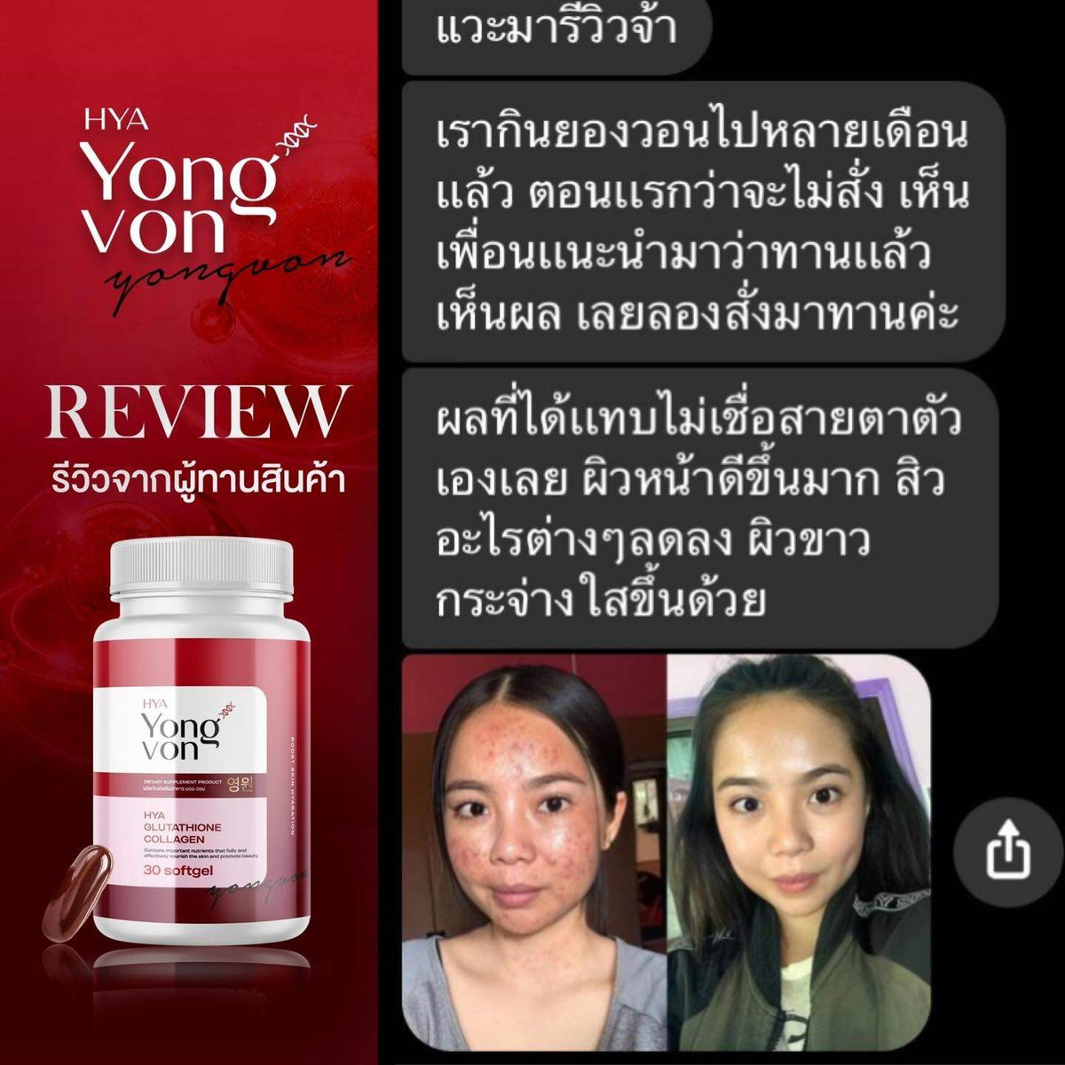 Yong Von HYA Gluta - Thaimegastore