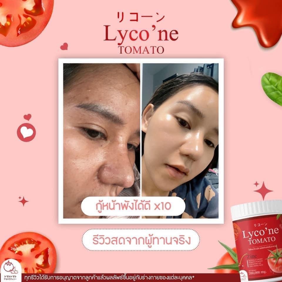 Lycone Tomato dietary supplement - Thaimegastore