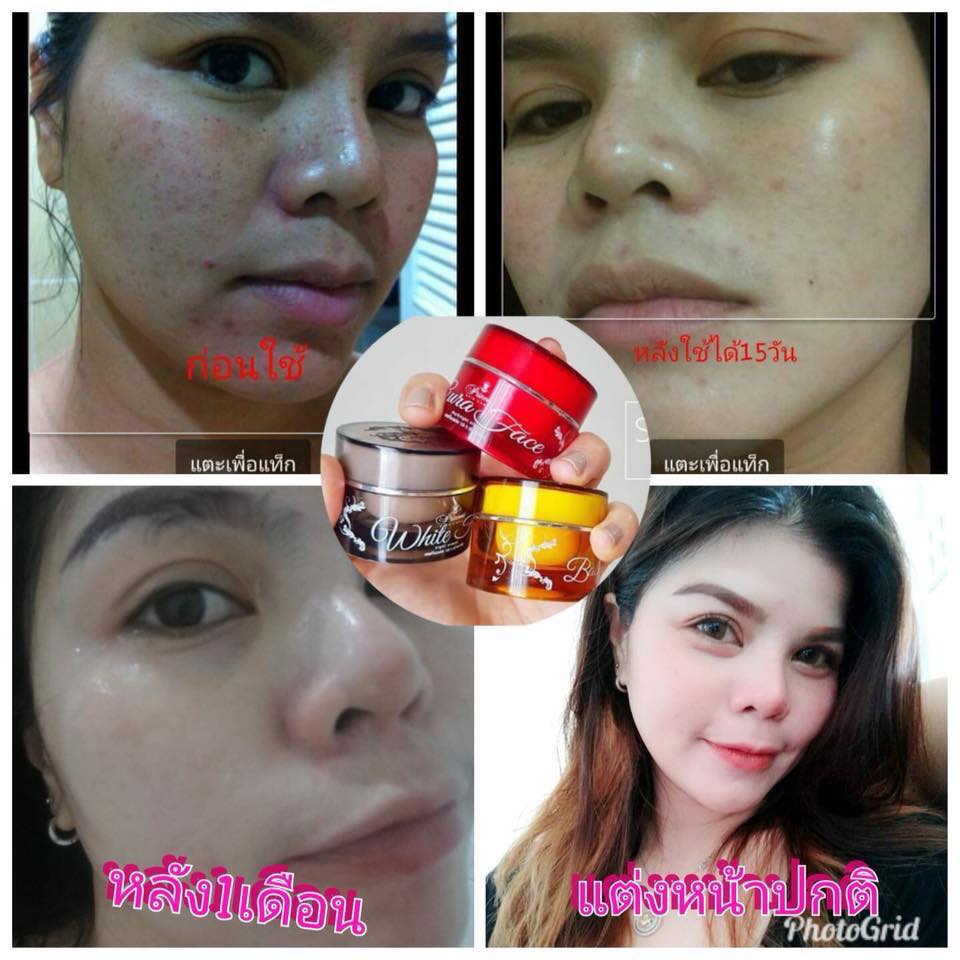 Aura Baby White Face Skin By Princess Skin Care Triple Set - Thaimegastore