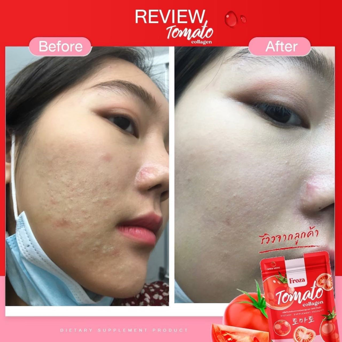 Froza Tomato collagen - Thaimegastore