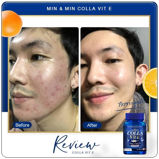 Min&Min Colla Vit E Plus - Thaimegastore