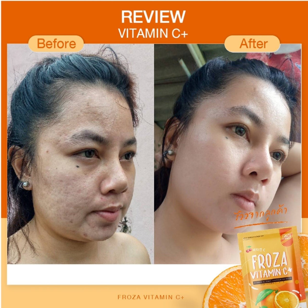 FROZA Vitamin C+ - Thaimegastore